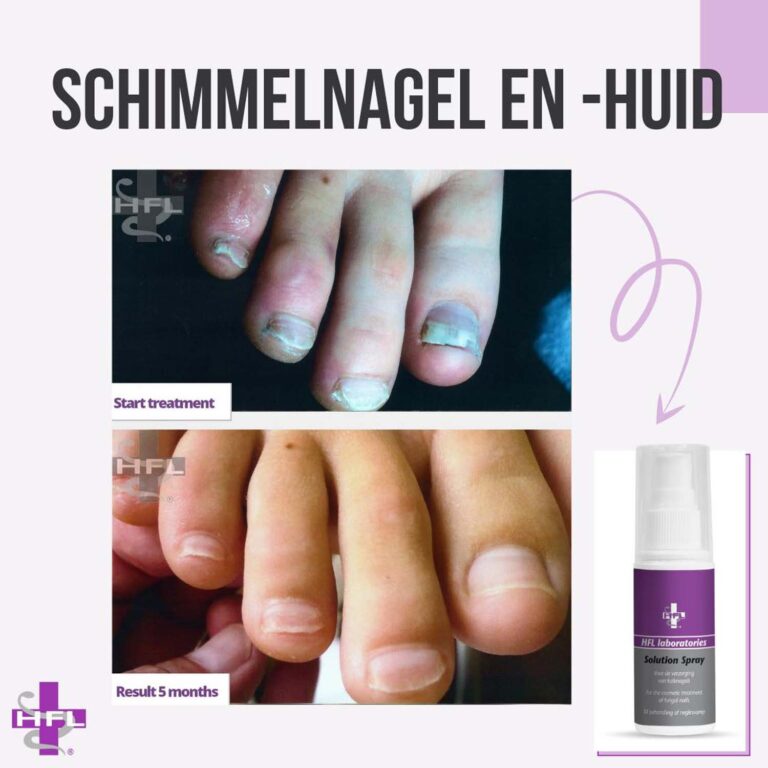 HFL Laboratories